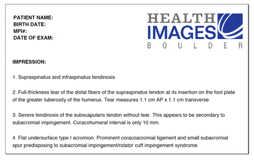 How to Read a Shoulder MRI Report - Regenexx®