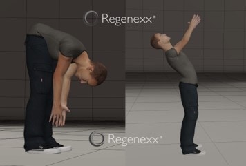 What is a Flexion-Extension X-ray? - Regenexx®