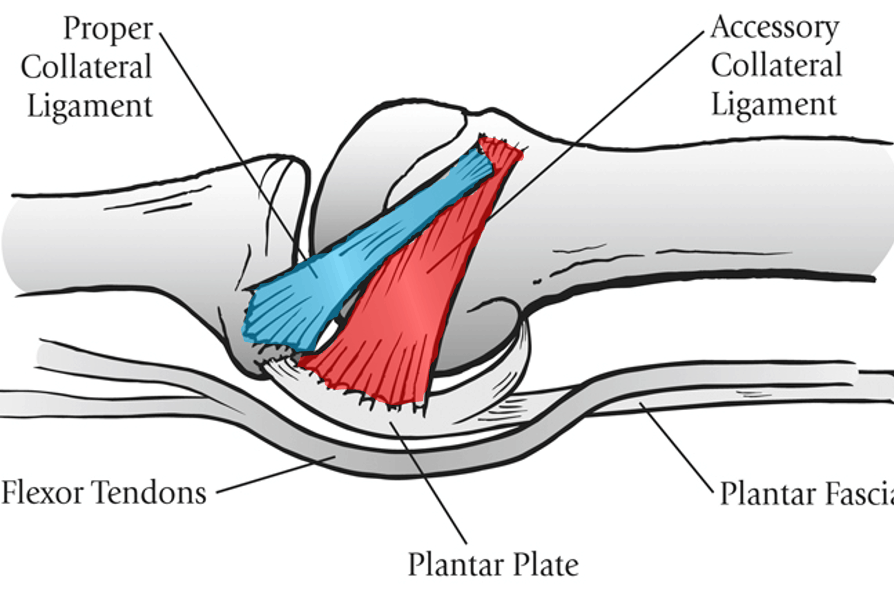 flexor hallucis longus tendon pain